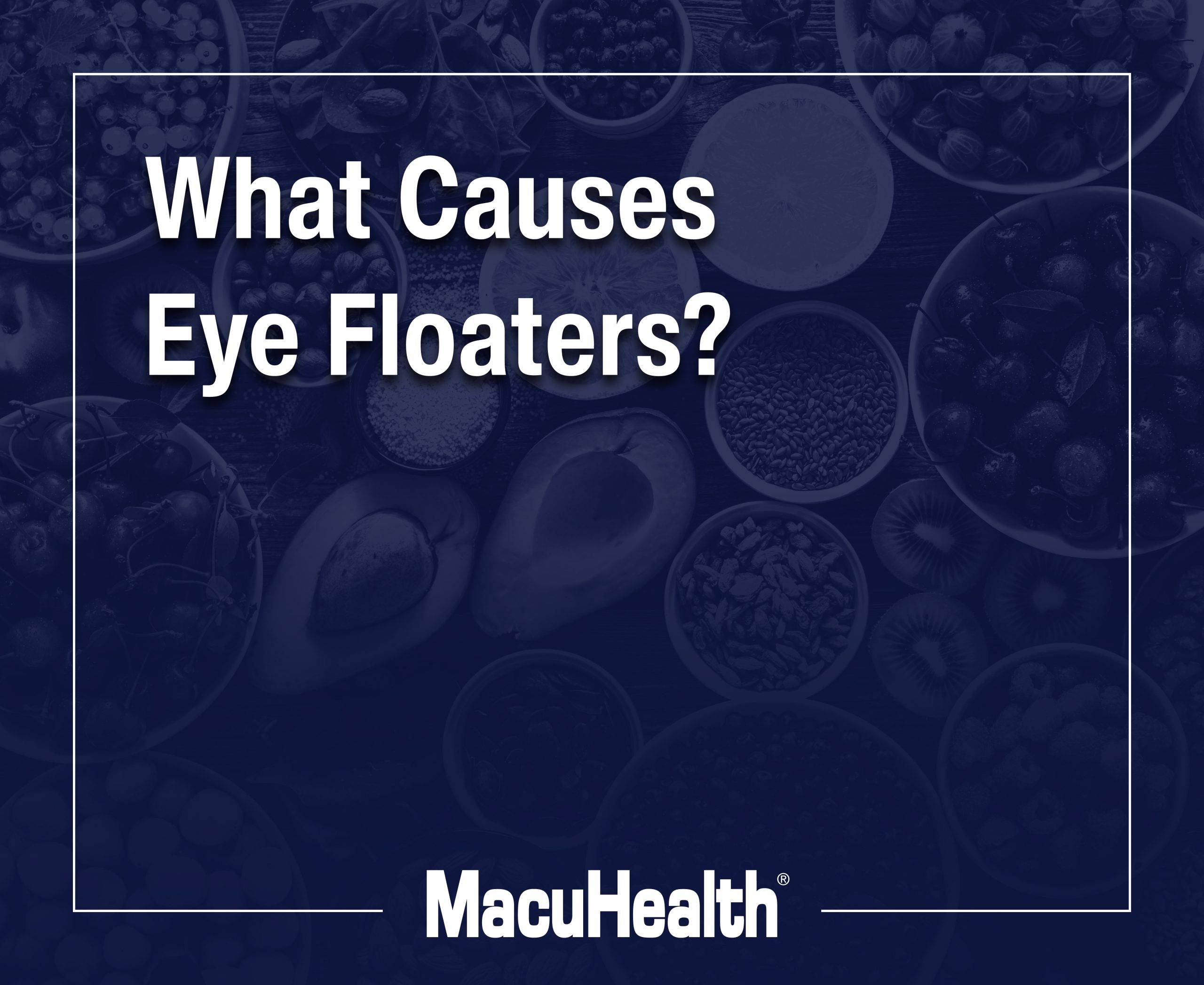 Learn About What Causes Eye Floaters - MacuHealth Learn About What Causes Eye Floaters - MacuHealth
